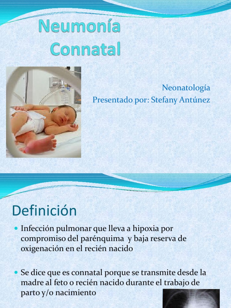 Neumonía congénita o neonatal: factores de riesgo, clasificación ...