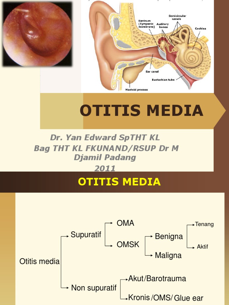 OTITIS MEDIA: PATHOGENESIS AND MANAGEMENT | PDF