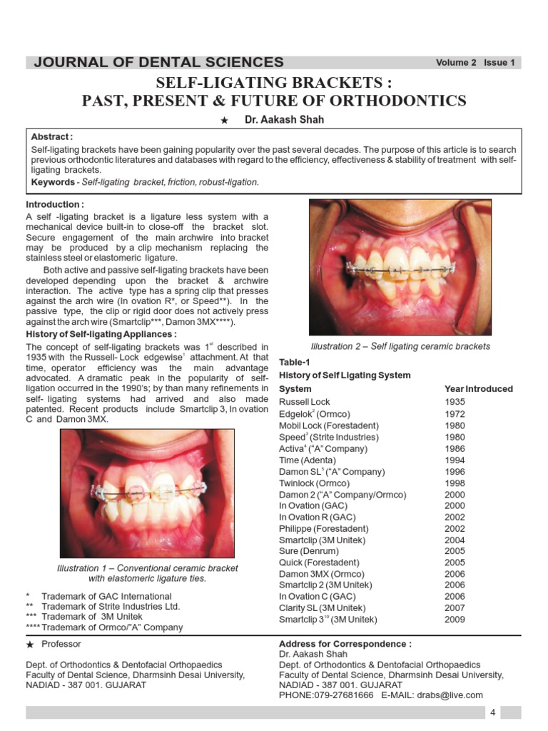 1.self Ligating Brackets Past Present Future of Orthodontics | PDF