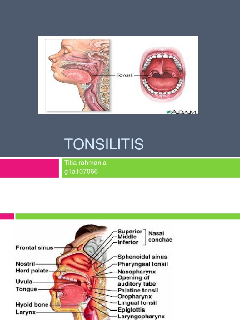 Tonsilitis | PDF