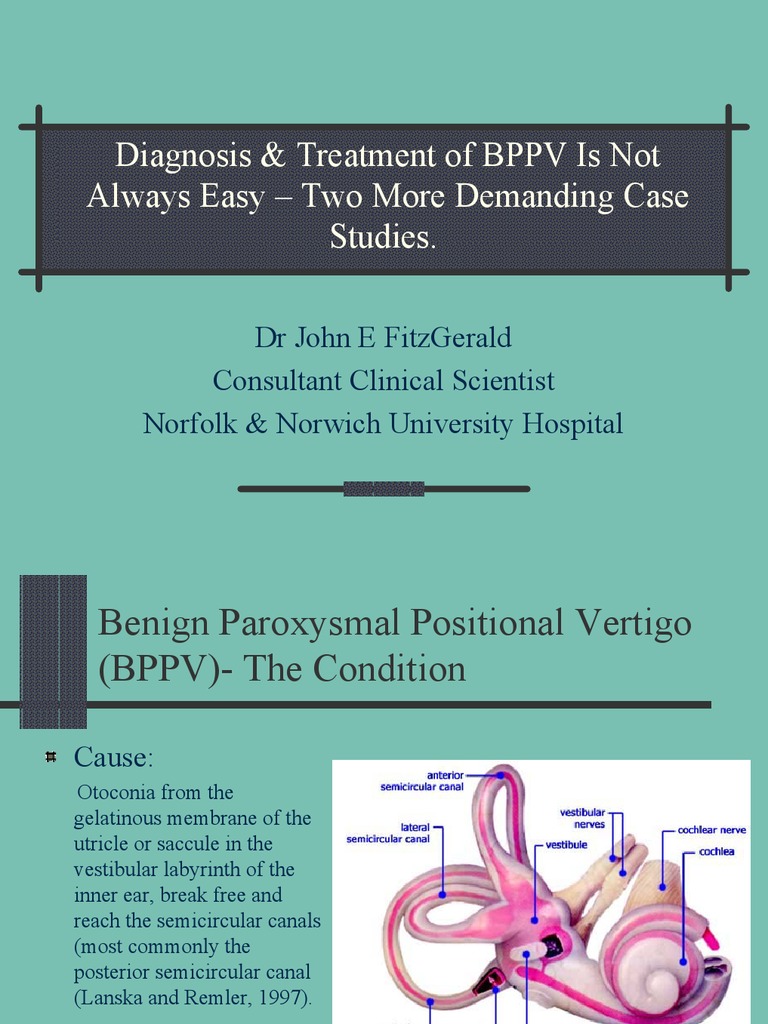 Diagnosis & Treatment of BPPV Not Always Straightforward | PDF ...