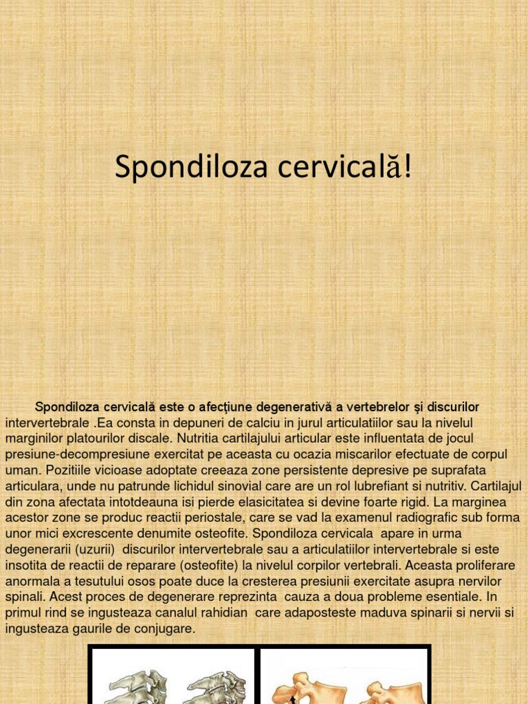 Spondiloza Cervicala | PDF