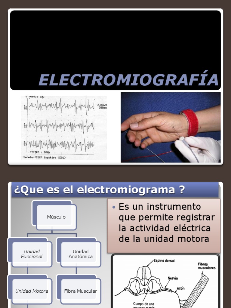 ELECTROMIOGRAFÍA