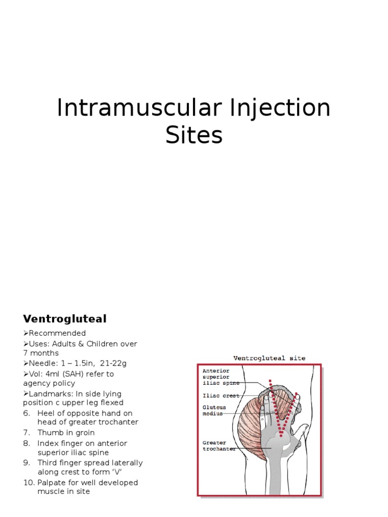 Ventrogluteal Injection Landmarks