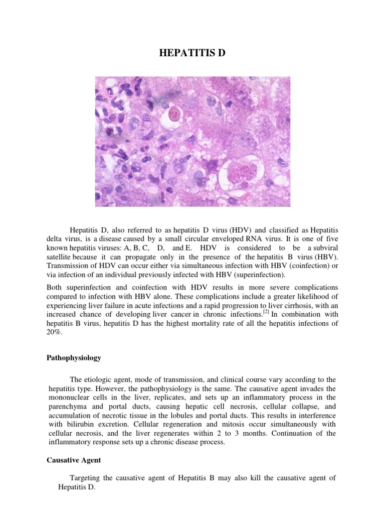 Hepatitis D: Pathophysiology | PDF | Hepatitis | Hepatitis B