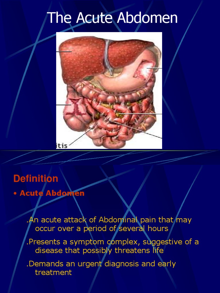 Acute Abdomen | PDF | Symptoms And Signs | Rtt