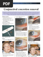 Visual Disability PWD ID Requirements | PDF | Visual Impairment ...