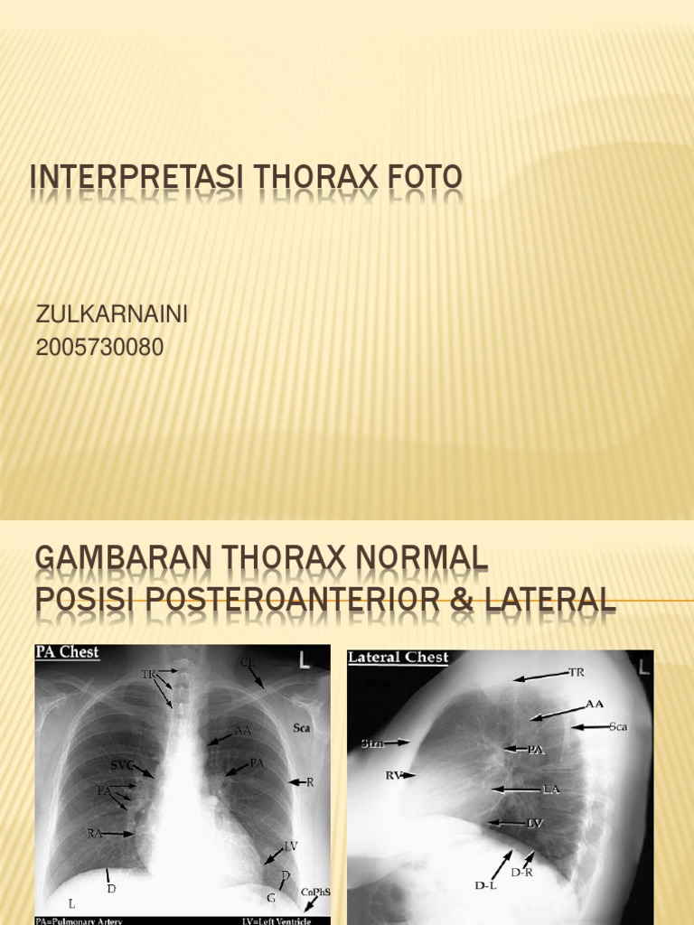 Interpretasi Foto Thorax Normal | PDF | Thorax | Human Anatomy