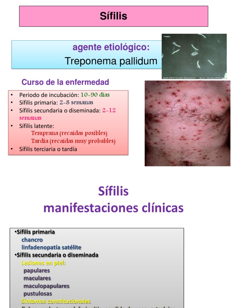 sifilis manif cutaneas | Estadísticas médicas | Afecciones urológicas