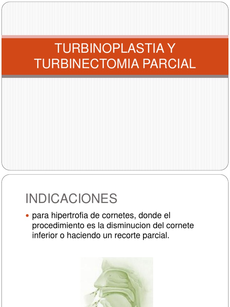 Turbinoplastia y Turbinectomia Parcial | Medicina | Medicina clínica