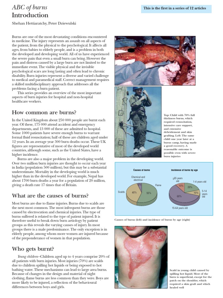 ABC of Burns | PDF | Burn | High Voltage