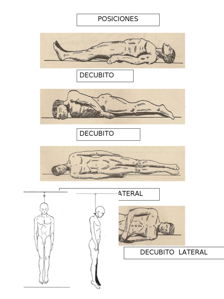 Posiciones Cadavéricas en Criminalística | PDF