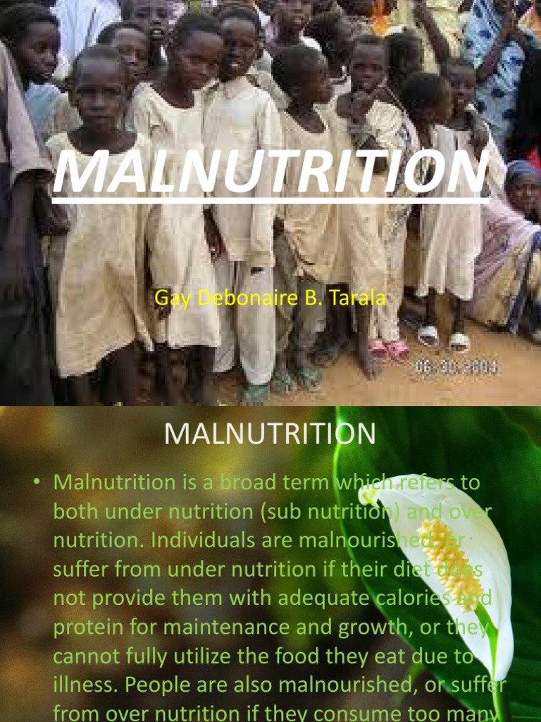 An In-Depth Look at Malnutrition: Causes, Signs, Treatment, and the ...