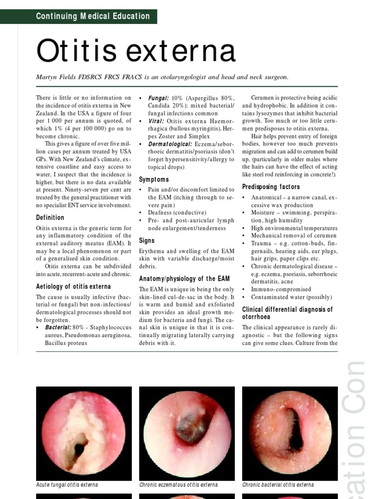 OTITIS EXTERNA Continuing Medical Education | PDF | Medical Specialties ...