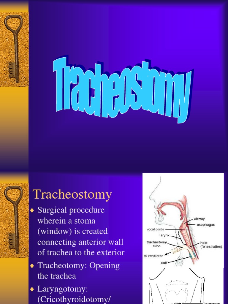 Tracheostomy 2 | PDF | Larynx | Neck