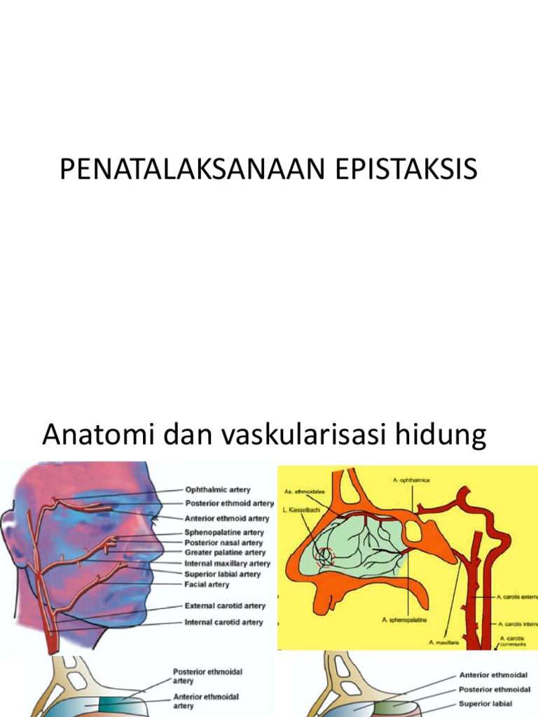 Tatalaksana Epistaksis Anterior dan Posterior | PDF | Kesehatan Holistik