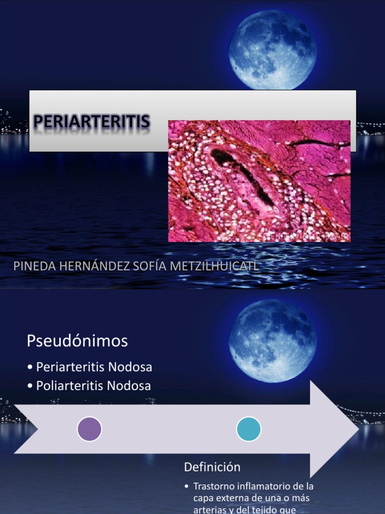 Periarteritis | PDF | Inflamación | Inmunología