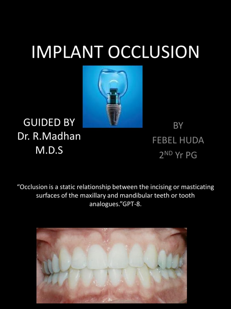 Implant Occlusion Final Ppt | Dental Implant | Tooth