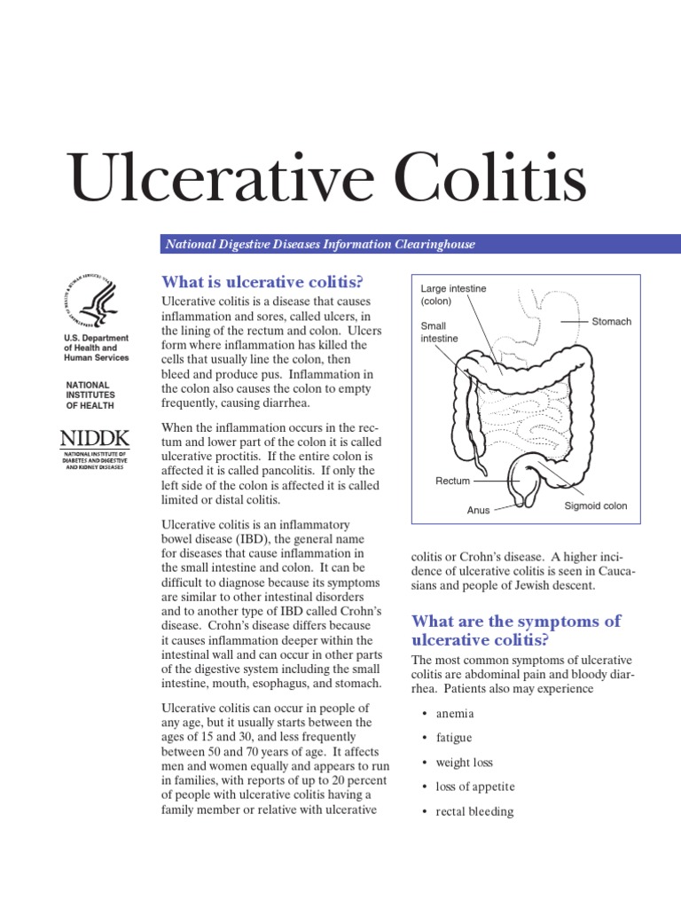 Ulcerative Colitis | PDF
