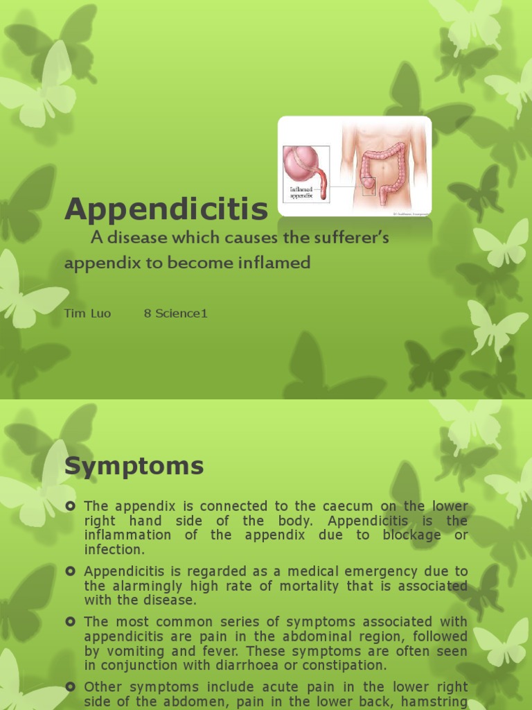 Appendicitis | PDF | Surgery | Gastroenterology