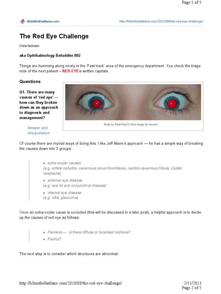 The Red Eye Challenge: Questions | PDF | Vision | Ophthalmology