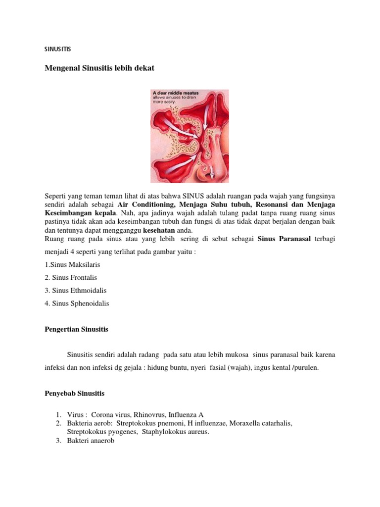 Sinusitis | PDF