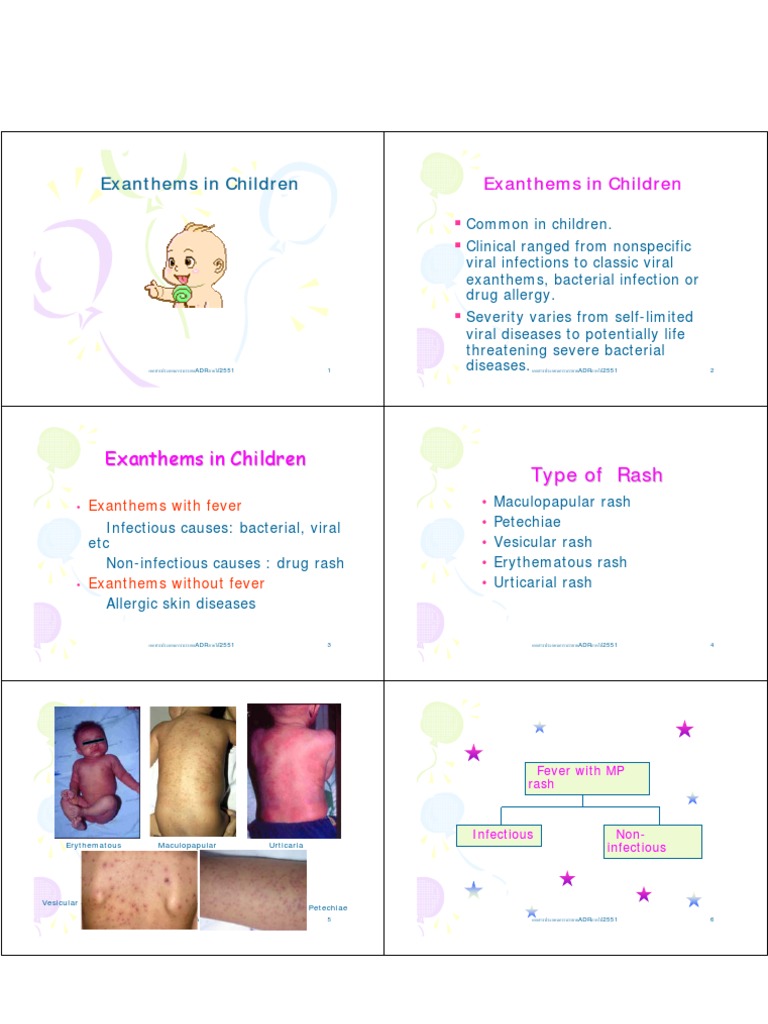 Viral Exanthematous Fever | PDF