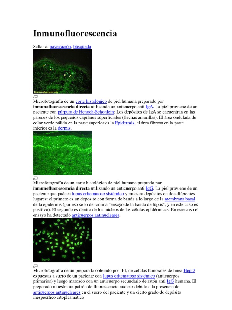Inmunofluorescencia | Inmunofluorescencia | Biología Celular