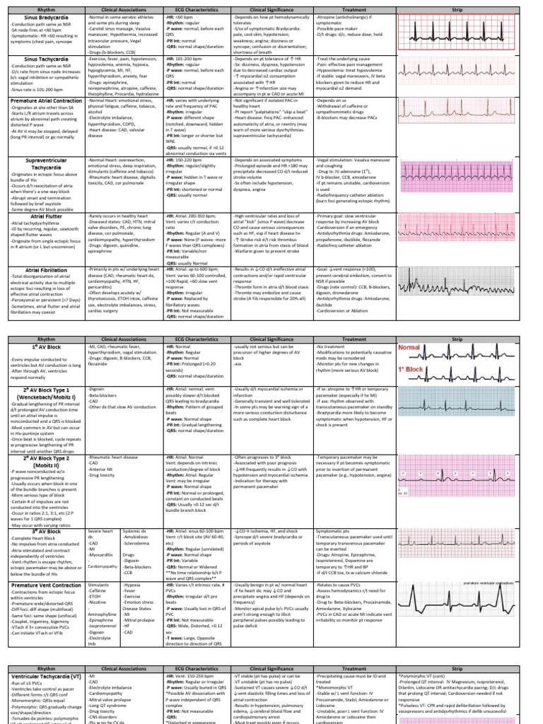 Cardiac Dysrhythmia Chart Med-Surg NUR4 | PDF | Cardiac ...