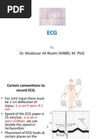 ECG Quiz: Key Questions & Answers | PDF | Electrocardiography ...