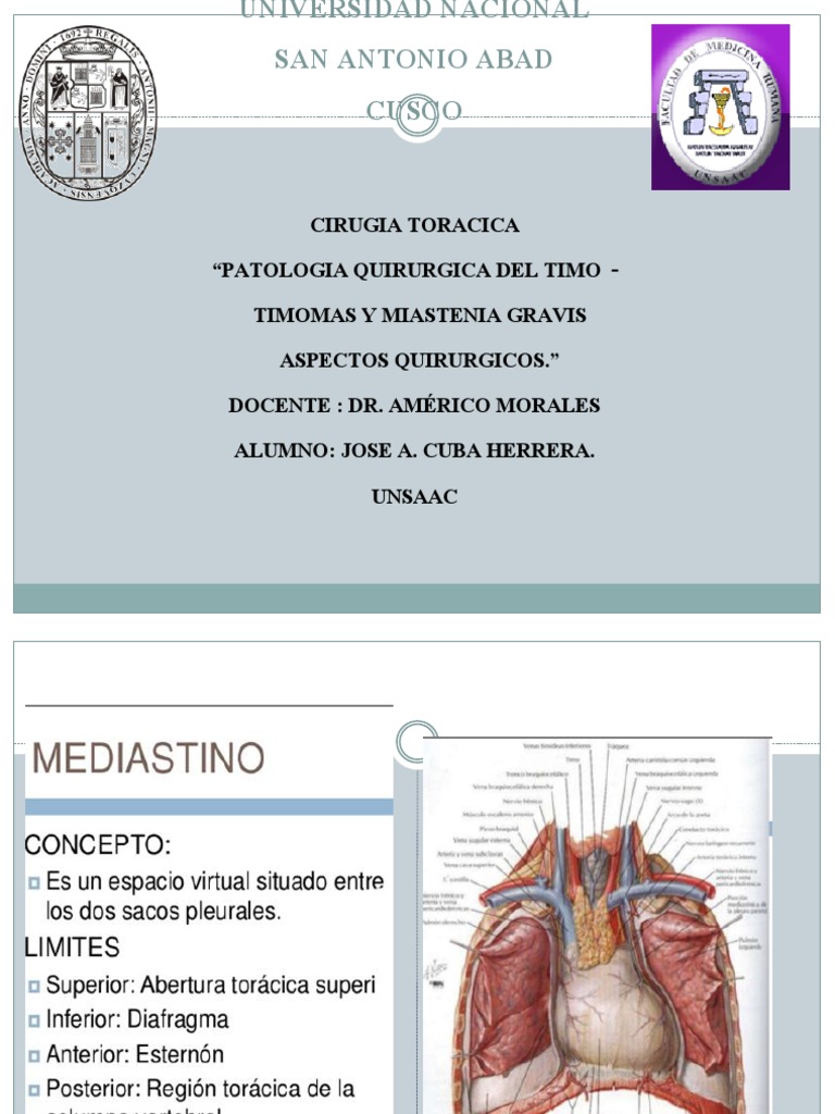 Timectomia | PDF | Timo | Neoplasias