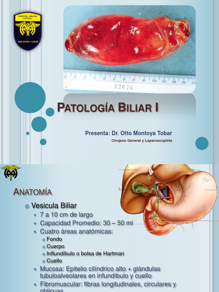 Colecistitis Aguda y Colelitiasis | Vesícula biliar | Hígado | Prueba ...