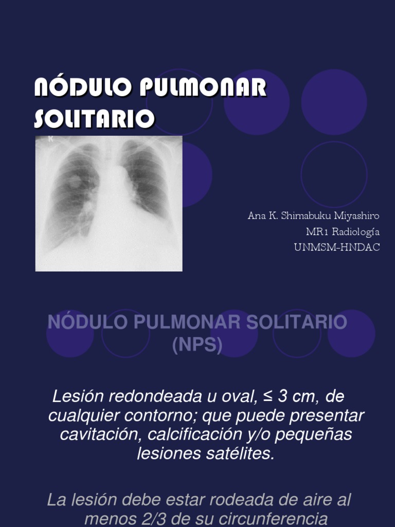 Nódulo Pulmonar Solitario | PDF | Especialidades Medicas | Medicina CLINICA