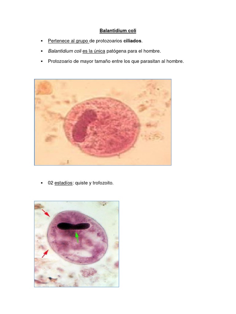 Balantidium Coli LABORATORIO | PDF | Nucleo celular | Anatomía