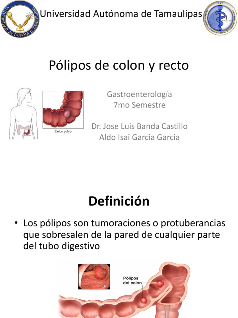 Pólipos de Colon y Recto ALDO | PDF | Cáncer colonrectal | Cáncer