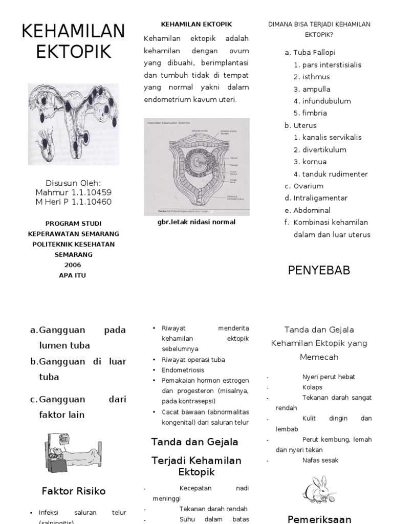 Leaflet Kehamilan Ektopik | PDF