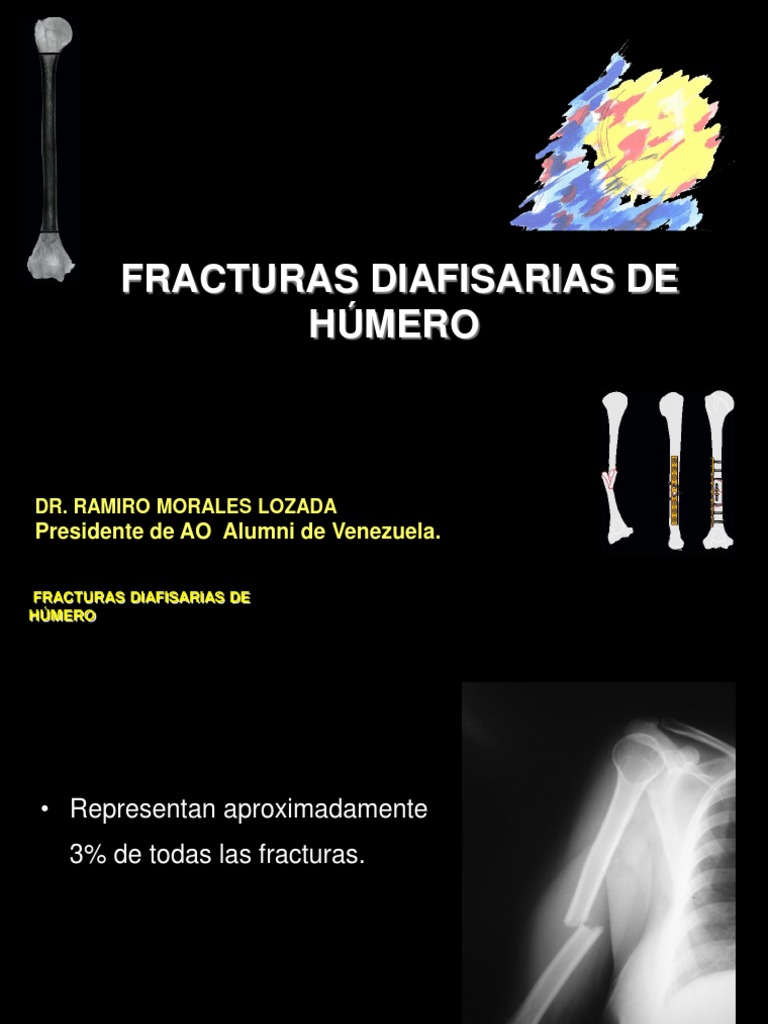 18.-Fracturas de Humero.ppt | Codo | Sistema musculoesquelético