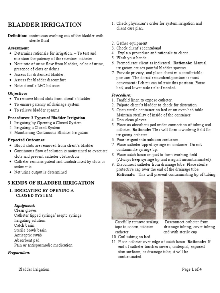 Bladder Irrigation (Cystoclysis) | PDF | Catheter | Syringe