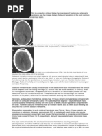 Bleed Vs Infarct Comparison | PDF | Nervous System | Neuroanatomy