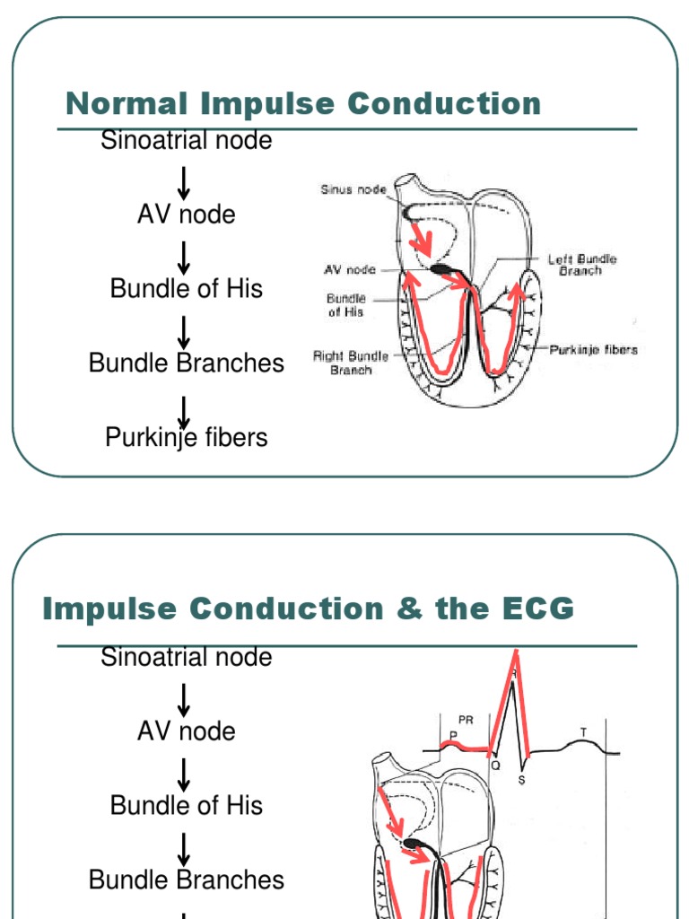 Normal Impulse Conduction: Sinoatrial Node | PDF | Electrocardiography ...