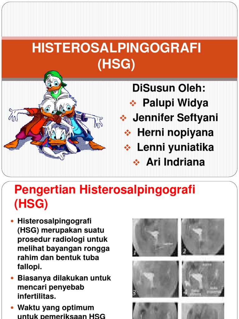 Prosedur Histerosalpingografi (HSG) | PDF