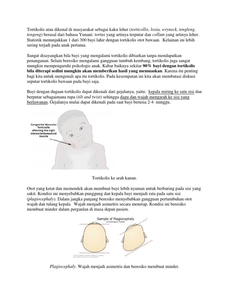 Memahami Tortikolis pada Bayi | PDF
