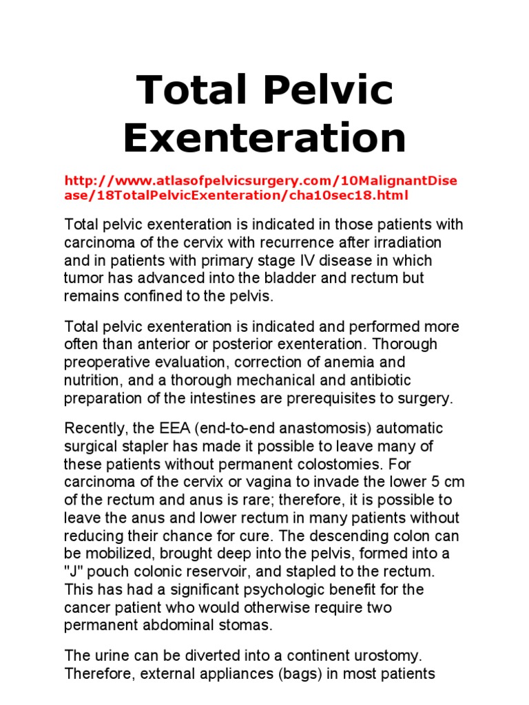 Total Pelvic Exenteration | Pelvis | Large Intestine