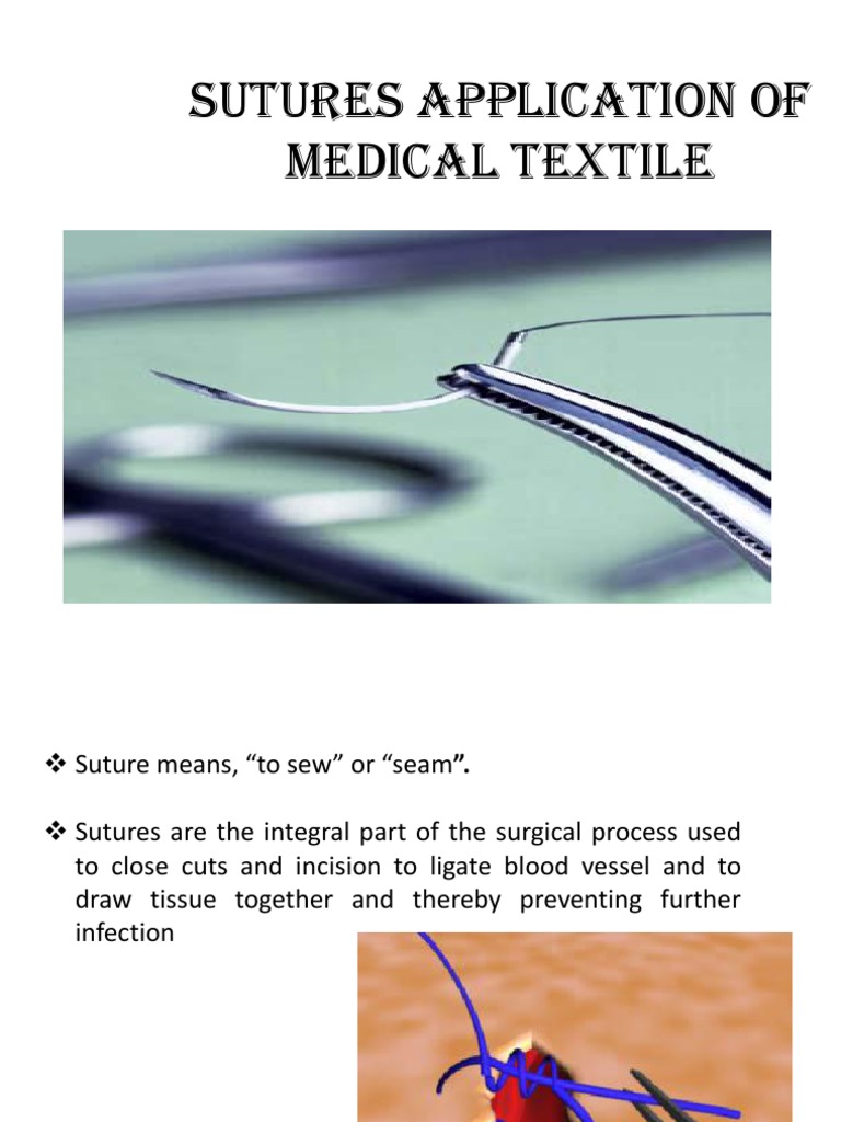 Sutures Application of Medical Textile | PDF | Surgical Suture | Wound
