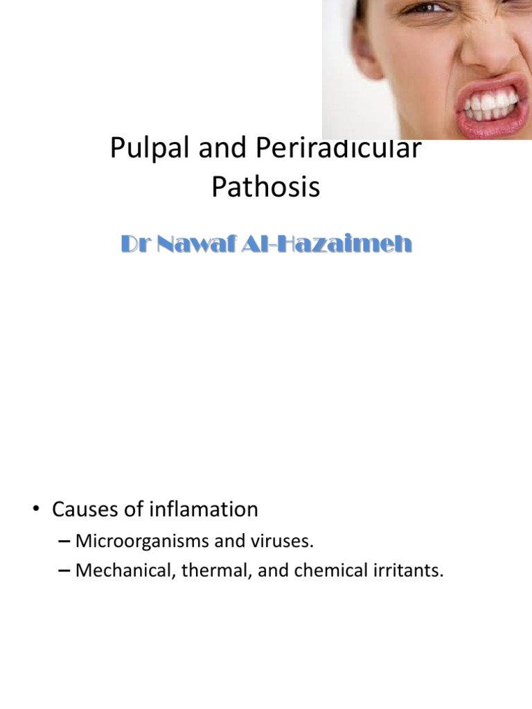 Slides 9 - Pulp and Periradicular Pathosis | PDF | Inflammation ...