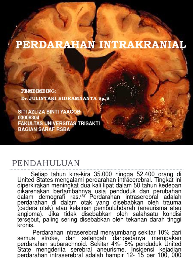 Perdarahan Intrakranial: Epidemiologi & Etiologi | PDF | Pengembangan ...