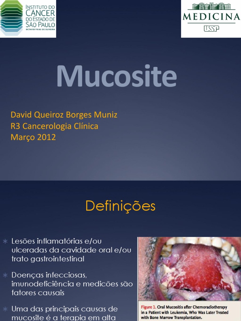 Mucosite | PDF | Câncer de pulmão | Câncer