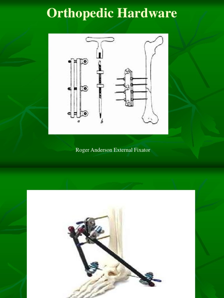 Overview of Orthopedic Hardware Types | PDF | Foreign Language Studies ...