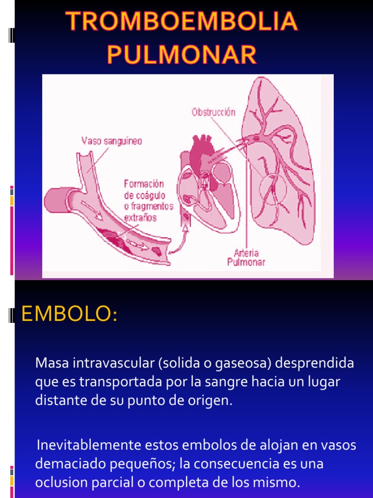 Tromboembolia Pulmonar | PDF | Embolia | Trombo