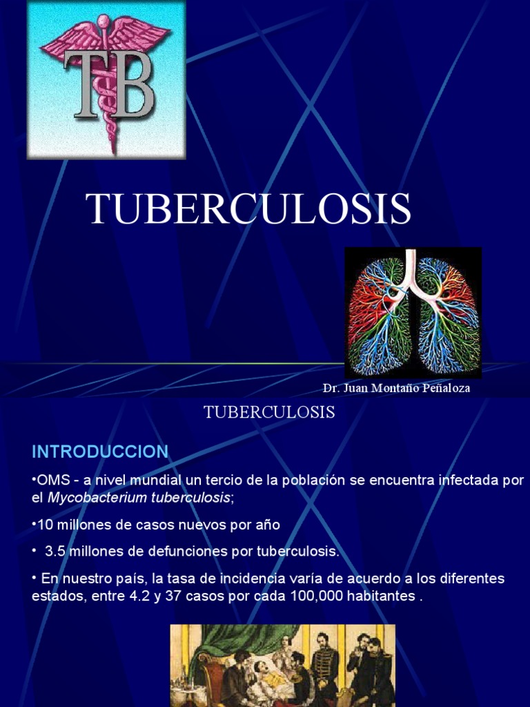 Tuberculosis | Descargar gratis PDF | Tuberculosis | Microbiología